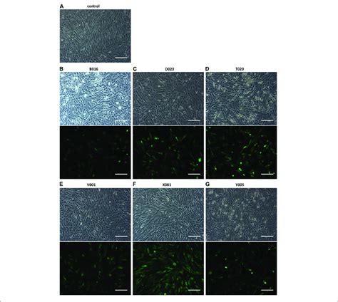 Nucleofection Optimization Of Cpcs With Different Programs A