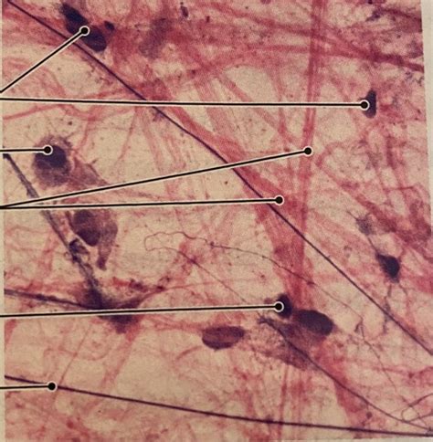 Connective Tissue Flashcards Quizlet