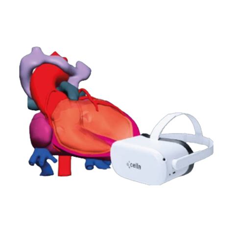 Medical Onex Cella Virtual Reality Environment Cella Medical Solutions Sl