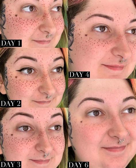 Fake Freckles Tattoo