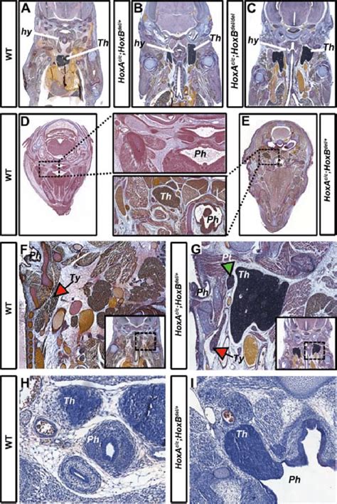 Ectopic And Hypertrophic Thymus A C Hypertrophic Thymuses Are Download Scientific Diagram