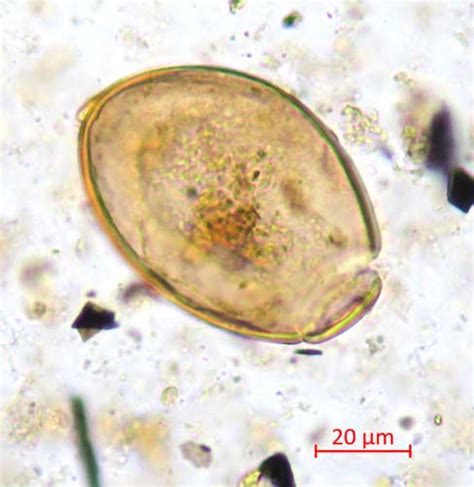 The Egg Of Diphyllobothrium Sp Tapeworm Download Scientific Diagram