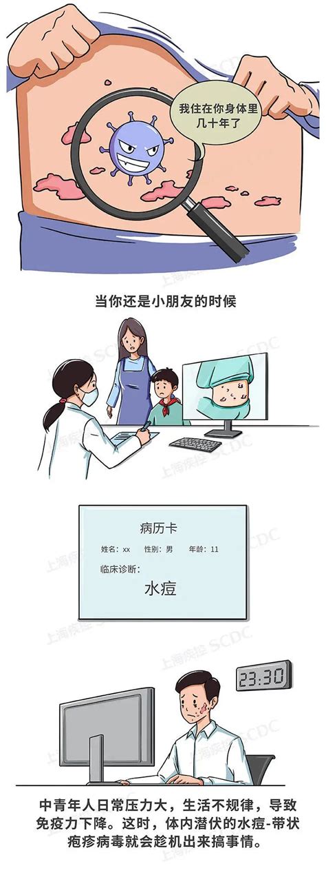 【科普常识】火龙附体，腰缠万贯——水痘 带状疱疹病毒（vzv）