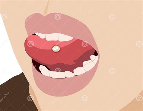 Aphthae Or Aphtha Tongue Close Up Unhealthy In Oral Illustration
