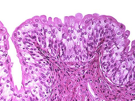 Transitional Epithelium Dome Shaped Apical Cells Squamous