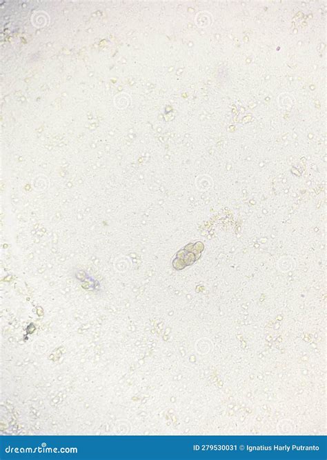 Hook Worm Eggs Of Parasite In Stool Examination Stock Image Image Of
