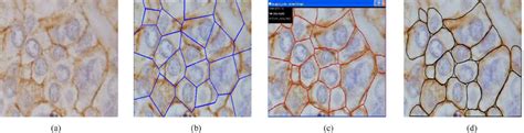 Comparison Between Membrane Approximation Obtained Through Standard