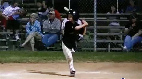 Doctors Said He Might Not Survive But What This One Legged Baseball