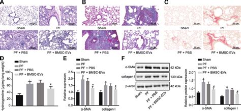 Bmsc Evs Suppresses Ipf In Vivo Ac He Staining A Masson Staining Download Scientific