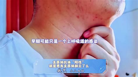 支原体抗体 阳性”，就是患有支原体肺炎了么手机新浪网