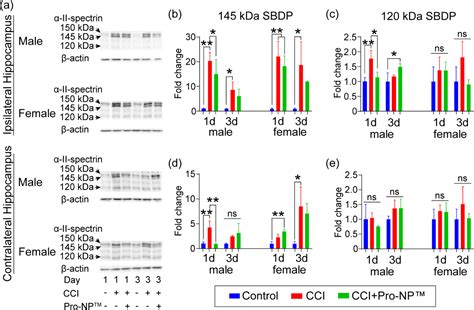 Sex Based Differences Of Antioxidant Enzyme Nanoparticle Effects