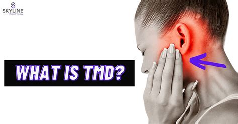 What Is Tmd