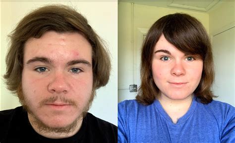 A Simple Heres What Hrt Does To Your Face If Thats What You Come