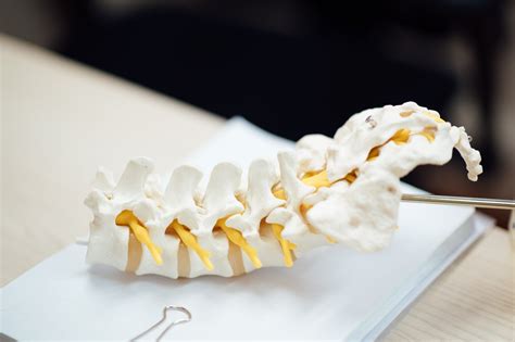 Nuvasive Introduces 3d Printed Porous Titanium Implant For Spine Surgery