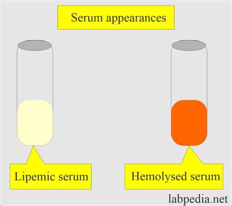 Common Lab Errors And Effect Of Various Anticoagulants On Tests