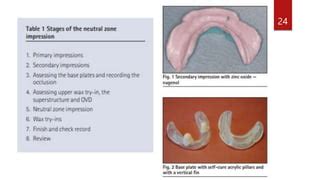 The Neutral Zone In Complete Dentures Pptx
