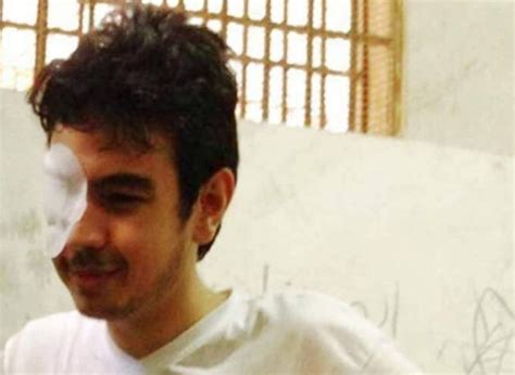 Anas Mousa Denied Treatment And Placed In Solitary Confinement Committee For Justice