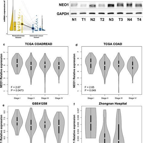 Gene Set Variation Analysis Gsva And Gene Set Enrichment Analysis