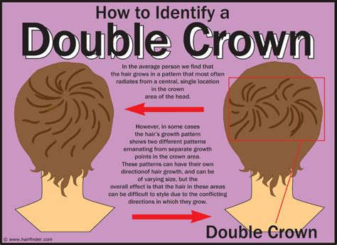 Hair Crown Types Hair Height At Crown Cowlick Crown Of Head Hair