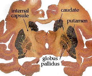 Globus Pallidus Globus Pallidus Externus Globus