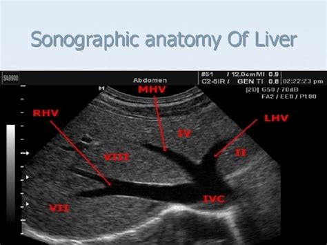 Introduction To Medical Ultrasonography Basic Introduction To Ultrasound