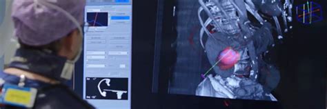 Tumor Biopsy And Ablation Philips