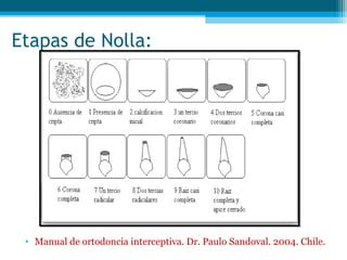 Tabla De Nolla 2b Ppt