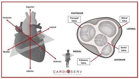 Finally Mitral Valve Orientation Explained Artofit