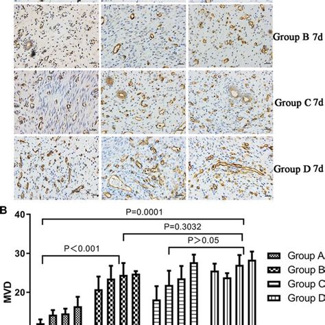 Immunohistochemical Staining Of Endometrial Cd31 And Mvd A