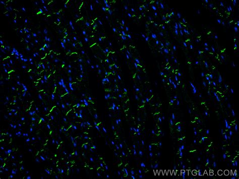 N Cadherin Antibody 66219 1 Ig Proteintech 武汉三鹰生物技术有限公司