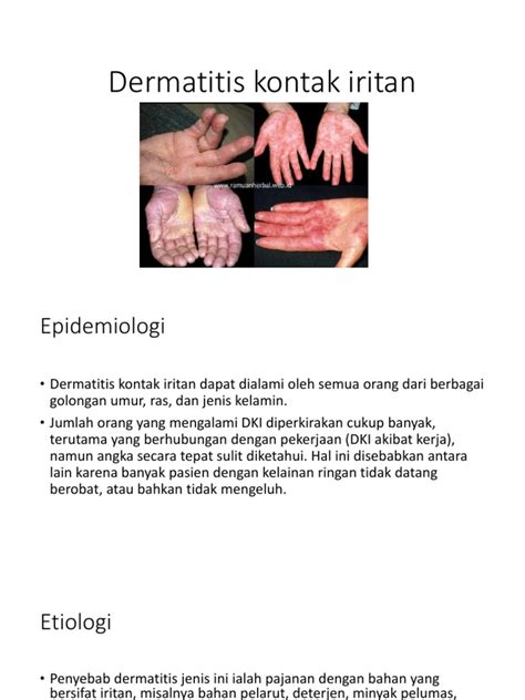 Dermatitis Kontak Iritan Pdf