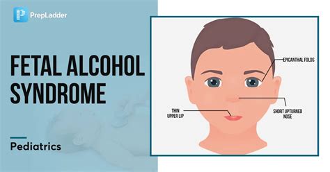 Fetal Alcohol Syndrome Causes Symptoms Risk Factors Diagnosis
