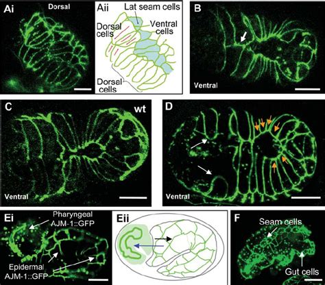 Plc 1tm753 Embryos Show Defective Epidermal Cell Migration