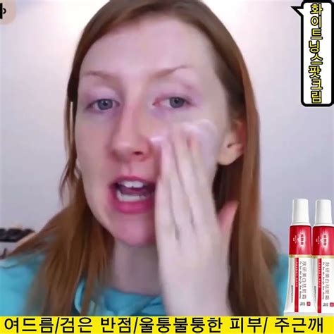 퀵 화이트닝 스팟 크림 피부를 환하게 하고 여드름검은 반점울퉁불퉁한 피부 주근깨 Youtube
