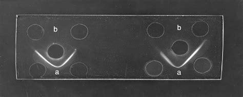Agar Gel Double Diffusion Test Against Antibodies Of Purified