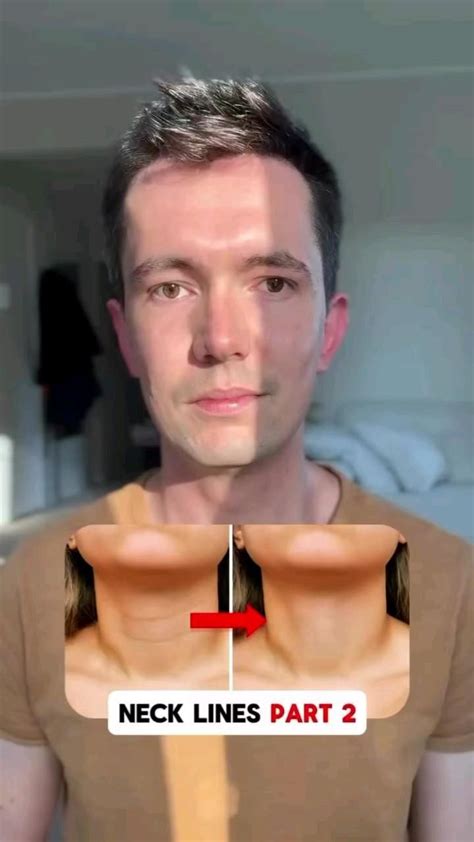 Best 13 Everything You Need To Know About Differin Acne Gel Artofit