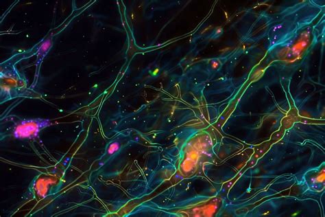 Revolutionizing Neuron Observation For Disease Insight Neuroscience News
