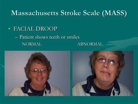 Ppt Mdphoems Stroke Point Of Entry Powerpoint Presentation Free