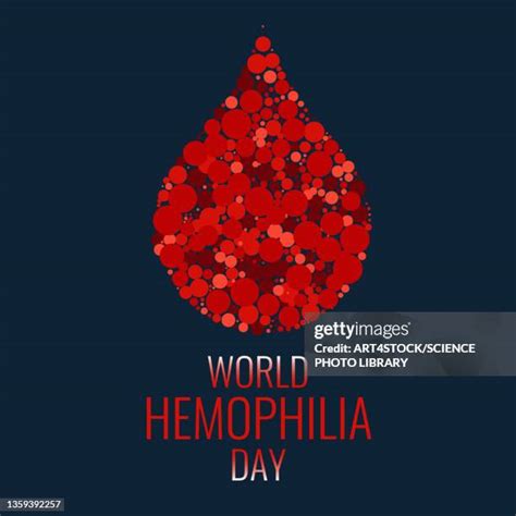 Hemophiliac Treatment Photos And Premium High Res Pictures Getty Images