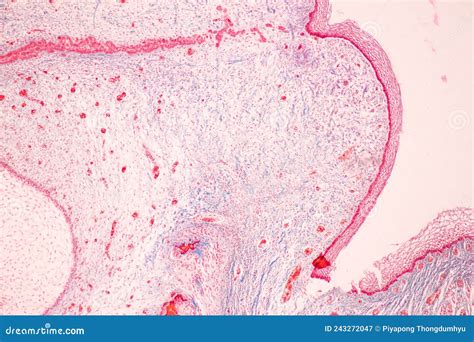 Tooth Development From Human Under Microscope Stock Image Image Of