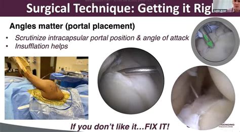 Posterior Shoulder Instability —
