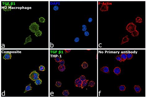 Tgf Beta 1 Antibody Pa1 29032