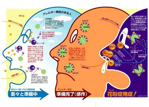 花粉症、症状出る前に効果的な治療を～初期療法と花粉の除去・回避で乗り切る～｜トピックス｜時事メディカル｜時事通信の医療ニュースサイト