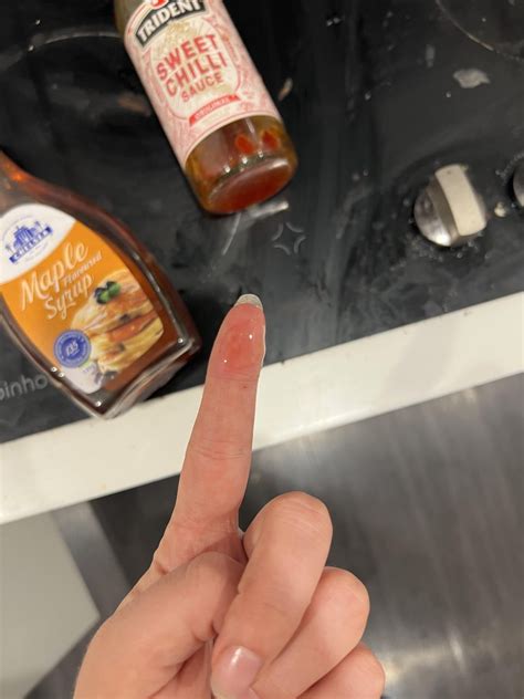 Squirting Random Condiments On My Finger And Licking It Off Until Im