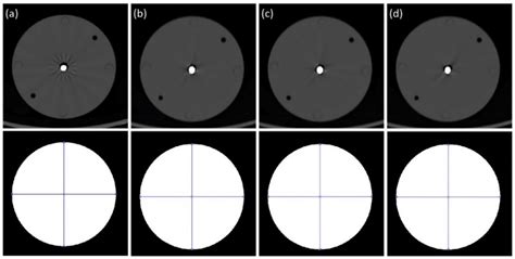 Images Showing Anteroposterior And Lateral Diameters From Various