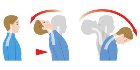 Concussion Management Spineline Chiro Essendon