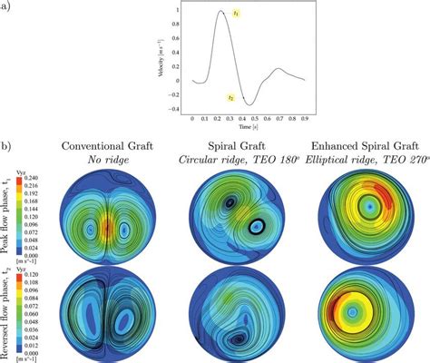 A Velocity Waveform At The Inlet And B Contours Of Secondary