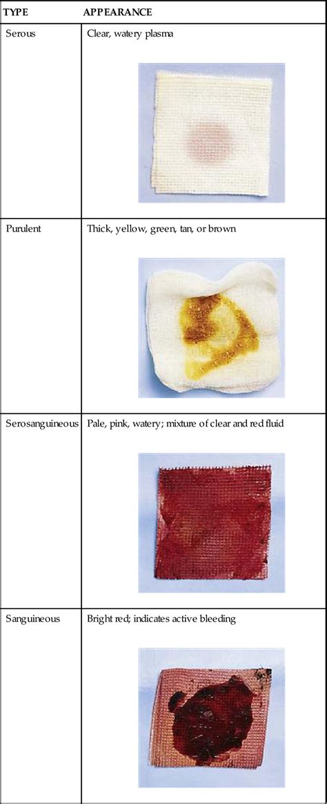 Serous Fluid Color