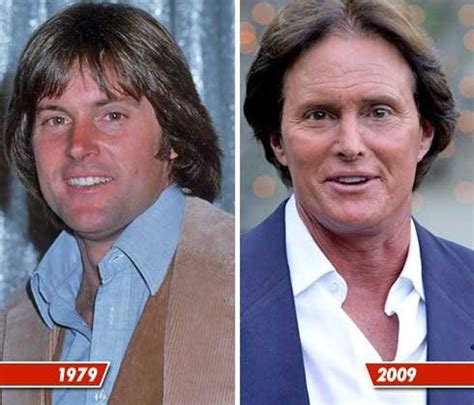 Celebrity Plastic Surgery Before And After 56 Pics Plastic Surgery