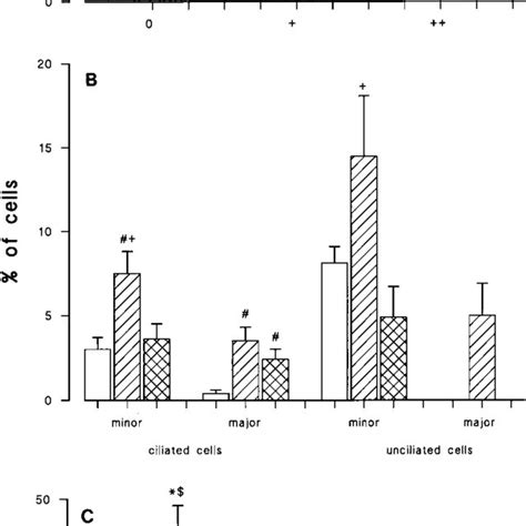 A Effect Of Dirithromycin On Cell Projection From Human Nasal Download Scientific Diagram